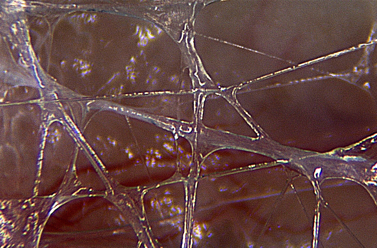 Embodied Tensegrity—Fascia and Yoga | Embodyoga®